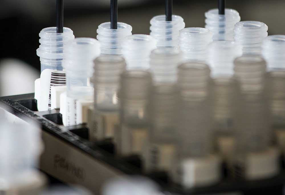 Identifying genetic and environmental influences on proteins associated ...