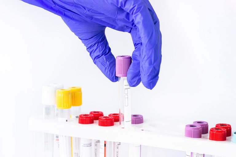 SomaLogic | Versatility