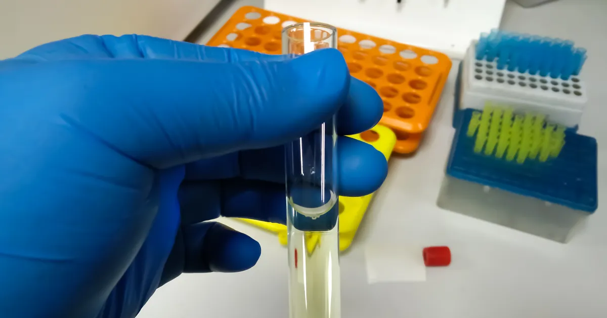 SomaScan® Assay Case Study: Advancing Biomarker Discovery in ...